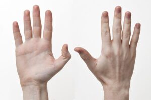 Hand vs. Arm: What's the Difference? - Main Difference