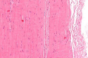 Tendon vs. Aponeurosis: What's the Difference? - Main Difference